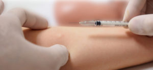 CANDIN - Candida Albicans Skin Test Antigen for Cellular Immunity